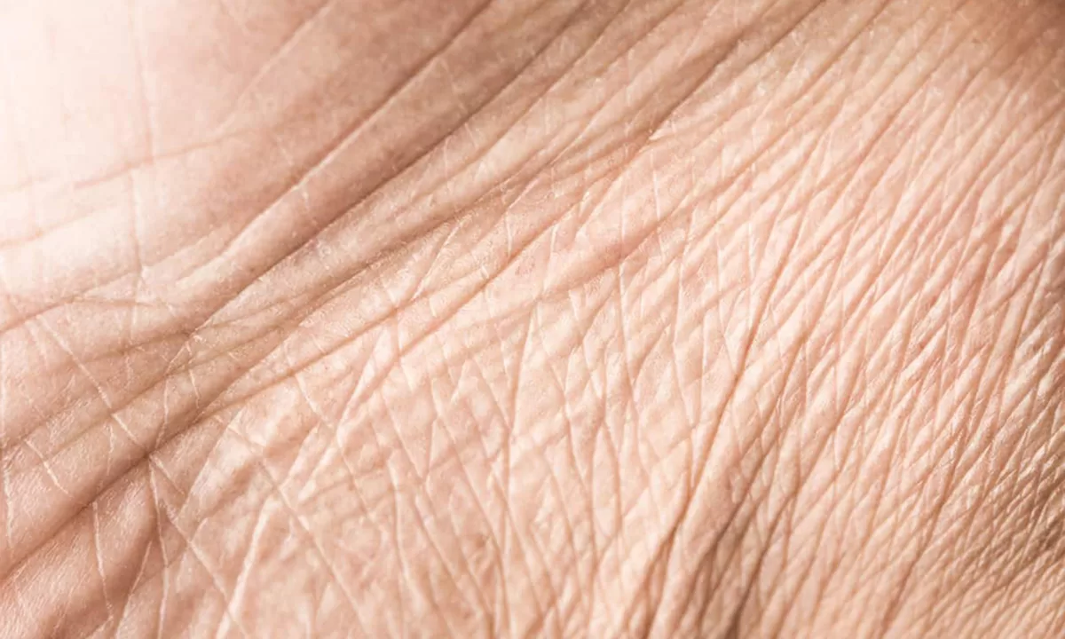 Sculptra Treatments | Sculptra Injections for Facial Aesthetics