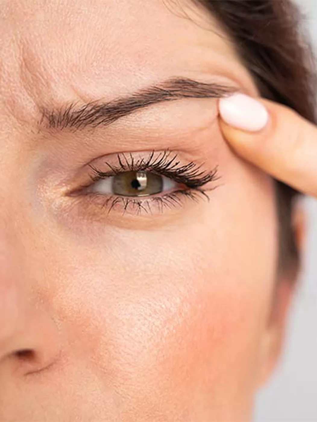 How Can I Improve Droopy Eyes at Home? | Direct Aesthetics