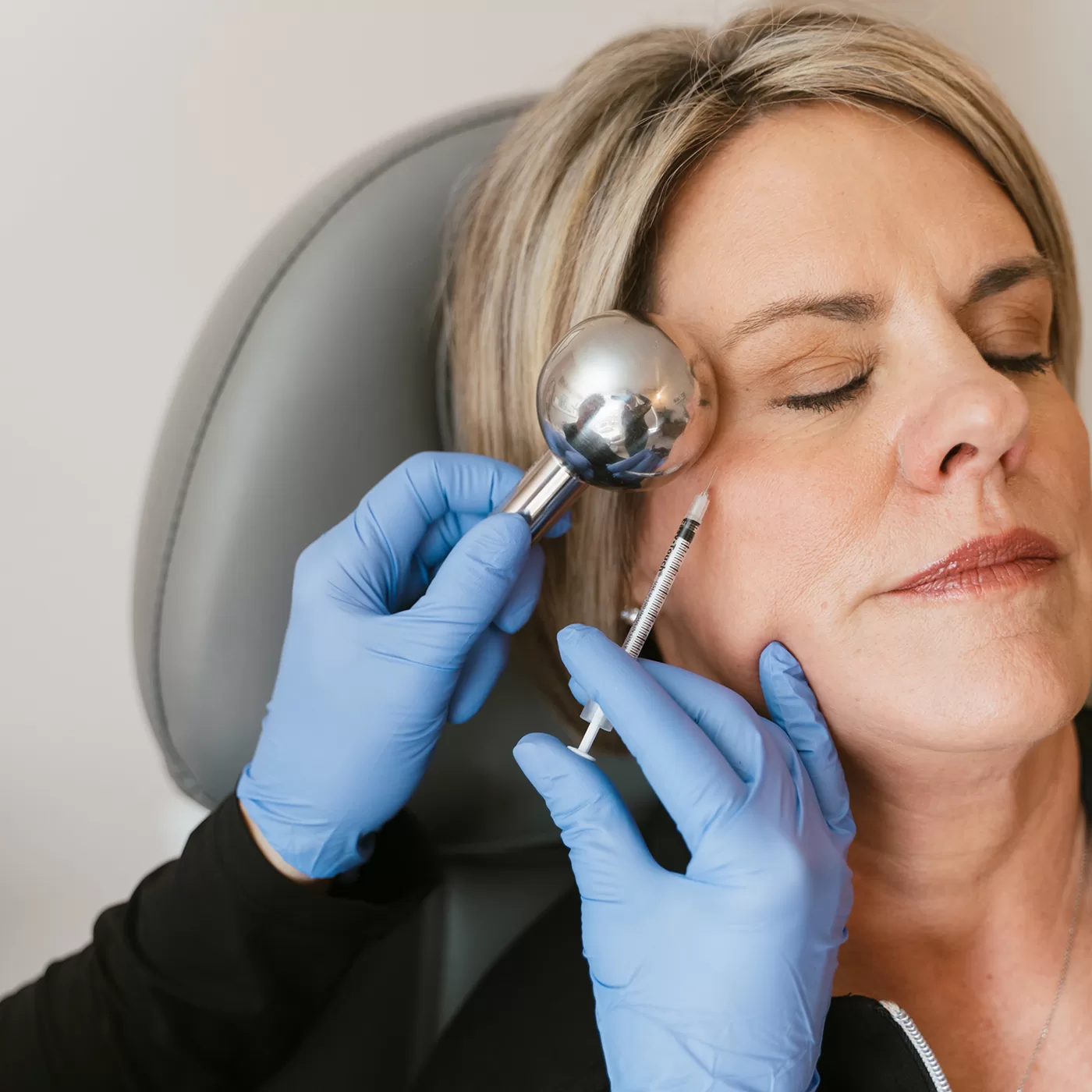 Crow’s Feet BOTOX® - Crow's Feet Treatment | Direct Aesthetics