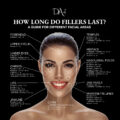 How Long do Fillers Last? Dermal Filler Lifespan and Duration
