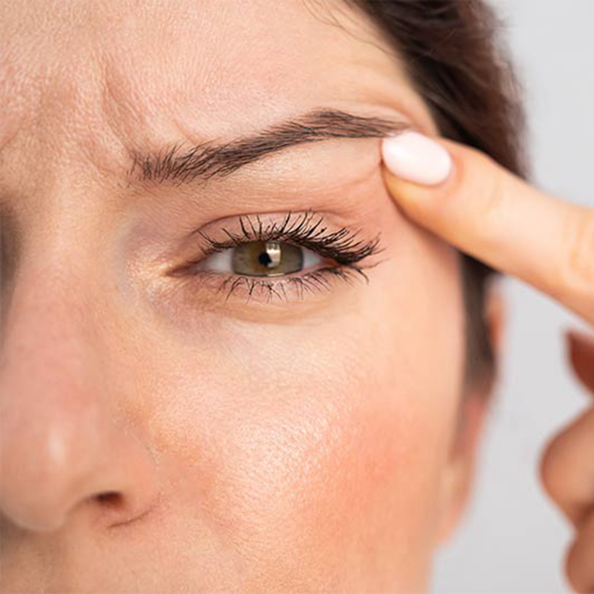 What are the Causes of Droopy Eyes and How to Treat Them?