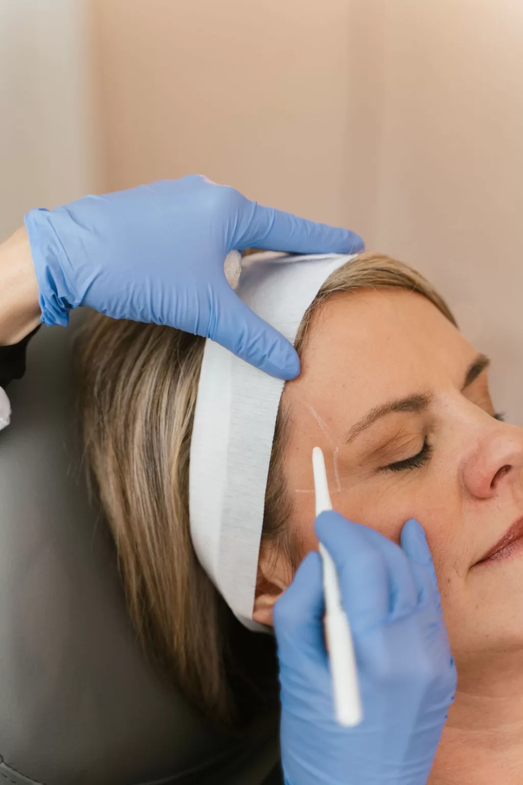 How Long do Fillers Last? Dermal Filler Lifespan and Duration