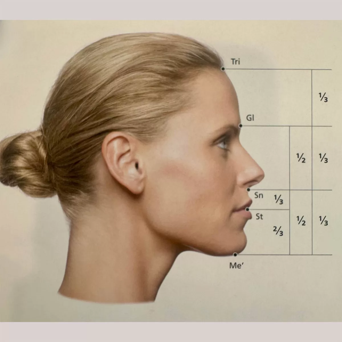 Facial Balancing: Before and After Treatment | Direct Aesthetics