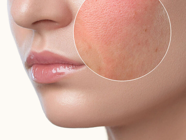 Surprising Ways Your Morning Coffee Affects Your Skin