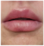 Lip Filler Swelling Timeline: How Long Will It Last?